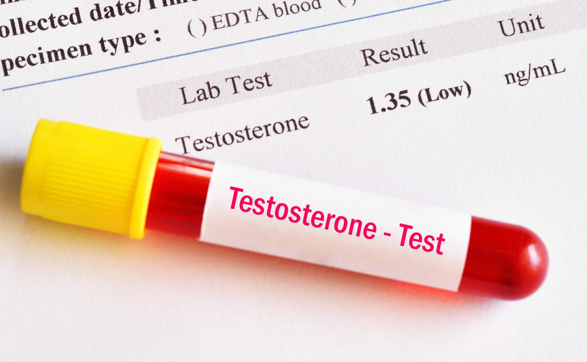 TRT with Enclomiphene: The Best TRT Protocol - Mesa TRT
